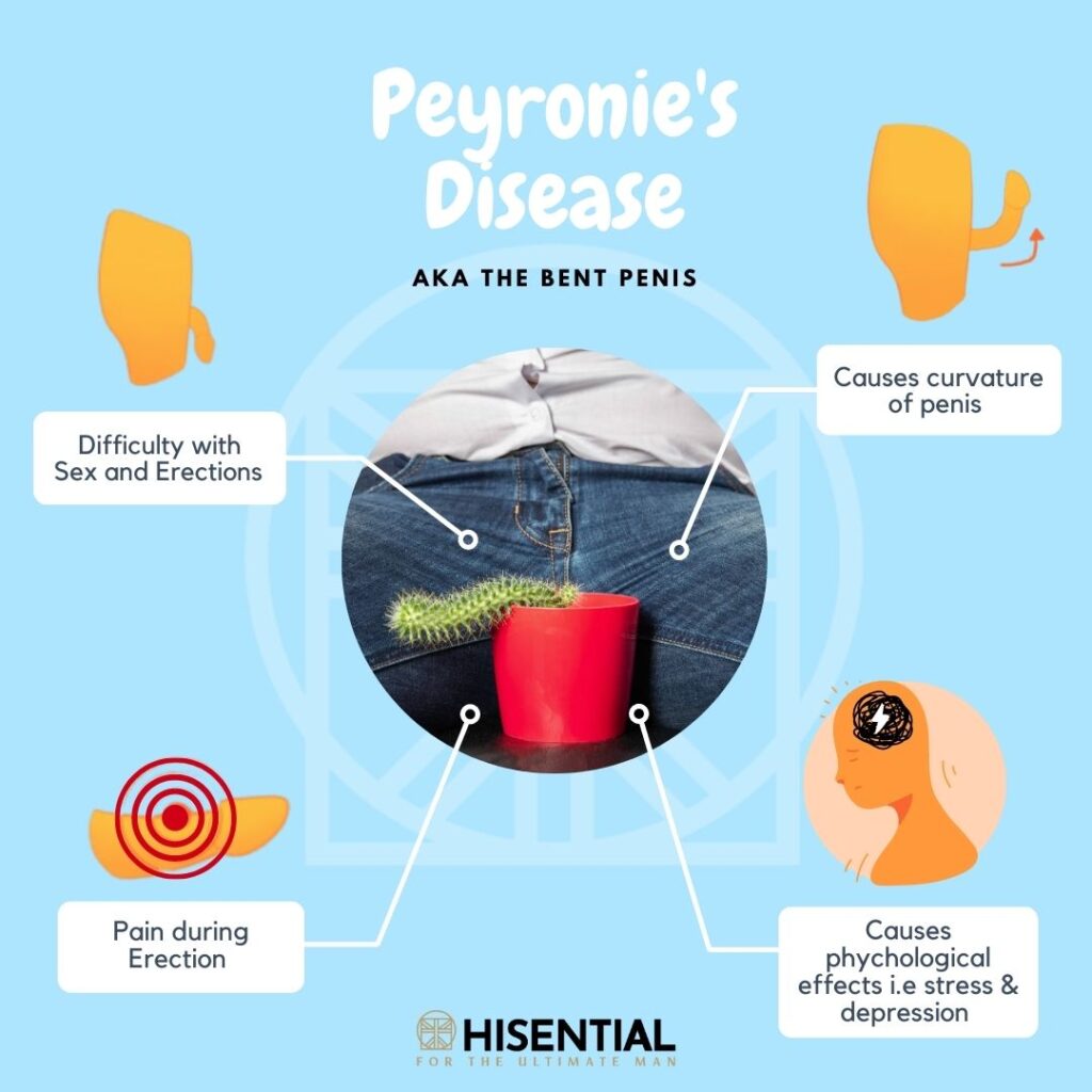 Peyronie’s Disease | Bent Penis | Curved Penis | Hisential